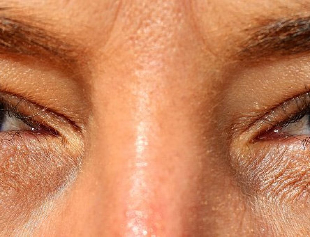 Glaucoma é uma das principais causas de cegueira irreversível – Dra ... Glaucoma é uma das principais causas de cegueira irreversível – Dra ...